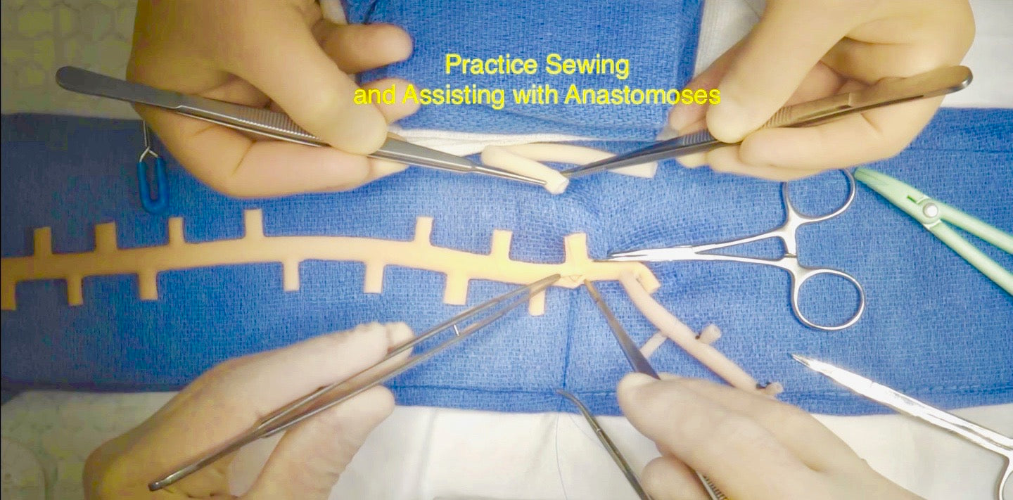 4" Conduits for Sewing Anastomoses and Assisting with Anastamoses ...